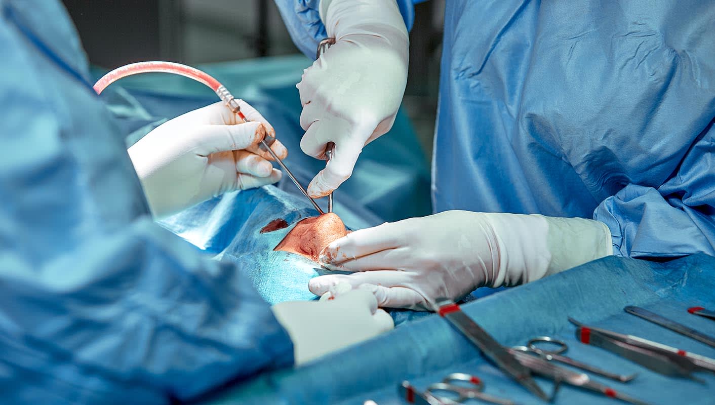 Six figure settlement involving rare nose cancer at Lewisham Hospital