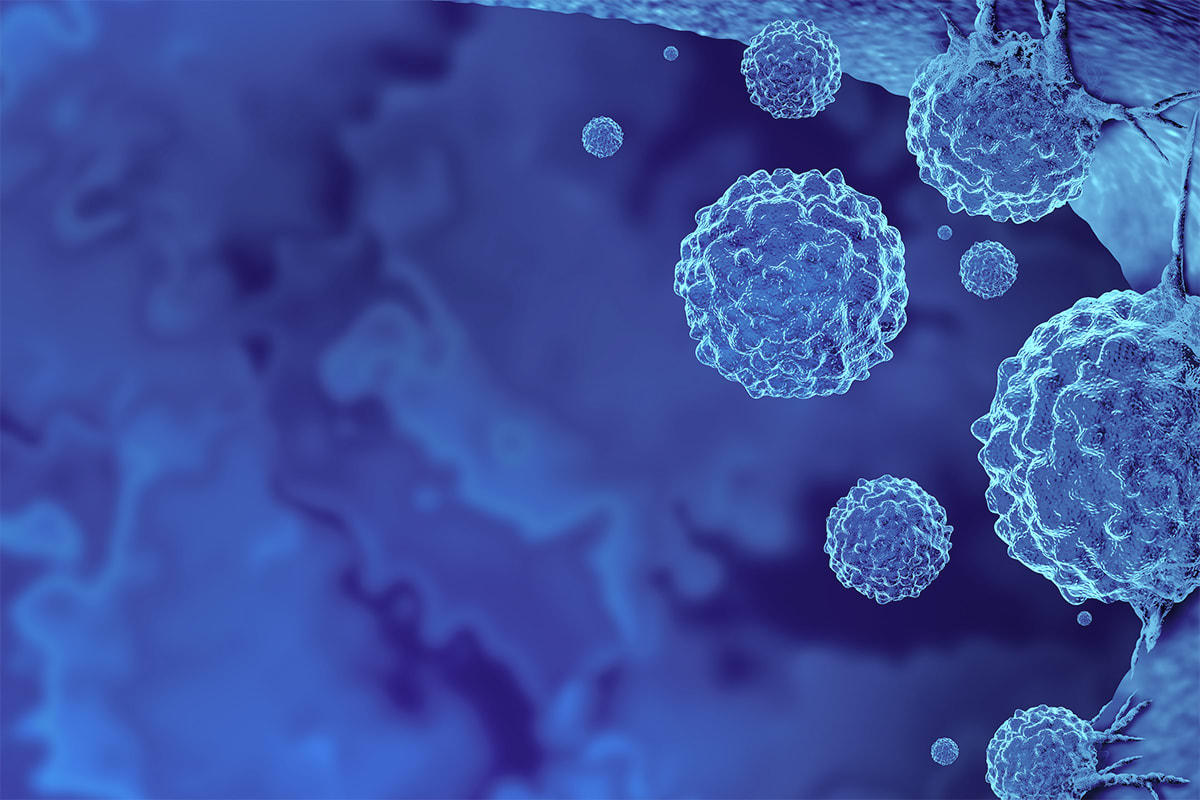 NHS Cancer Survival Rates Rise, But Mesothelioma Lags