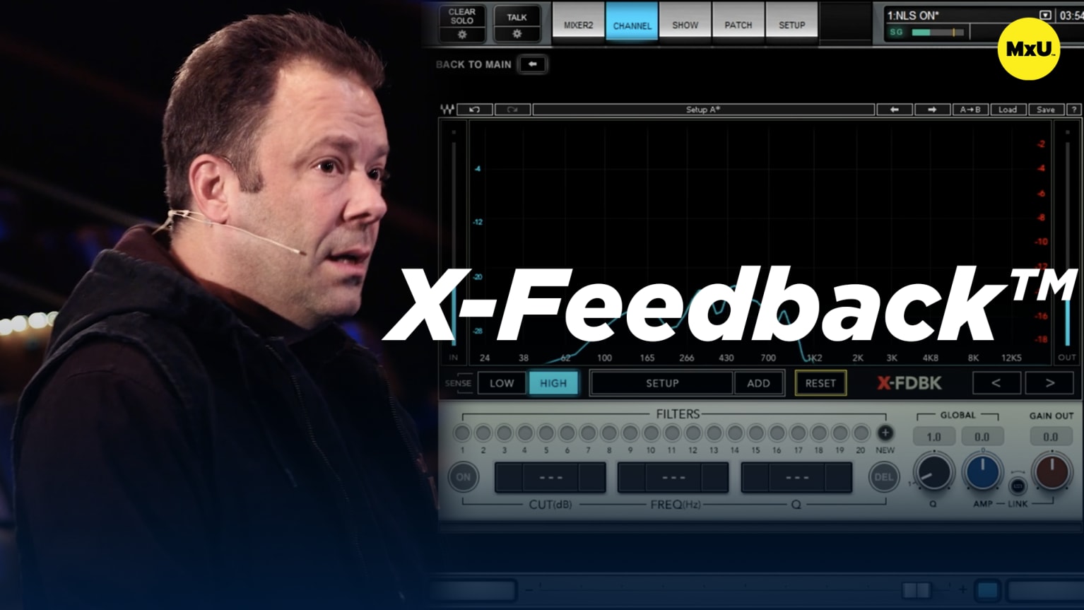 X-Feedback™ - MxU