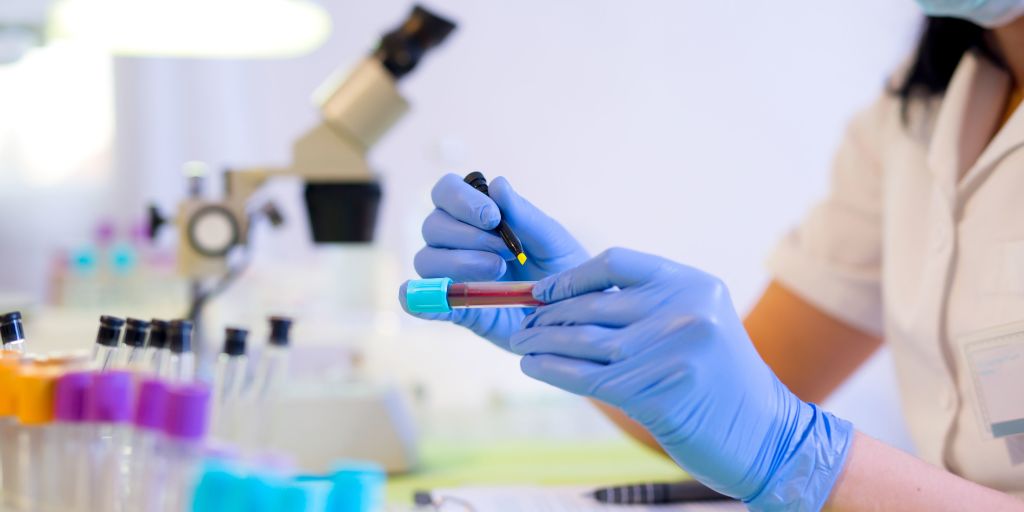 How a blood test may help rheumatoid arthritis patients - Sharecare