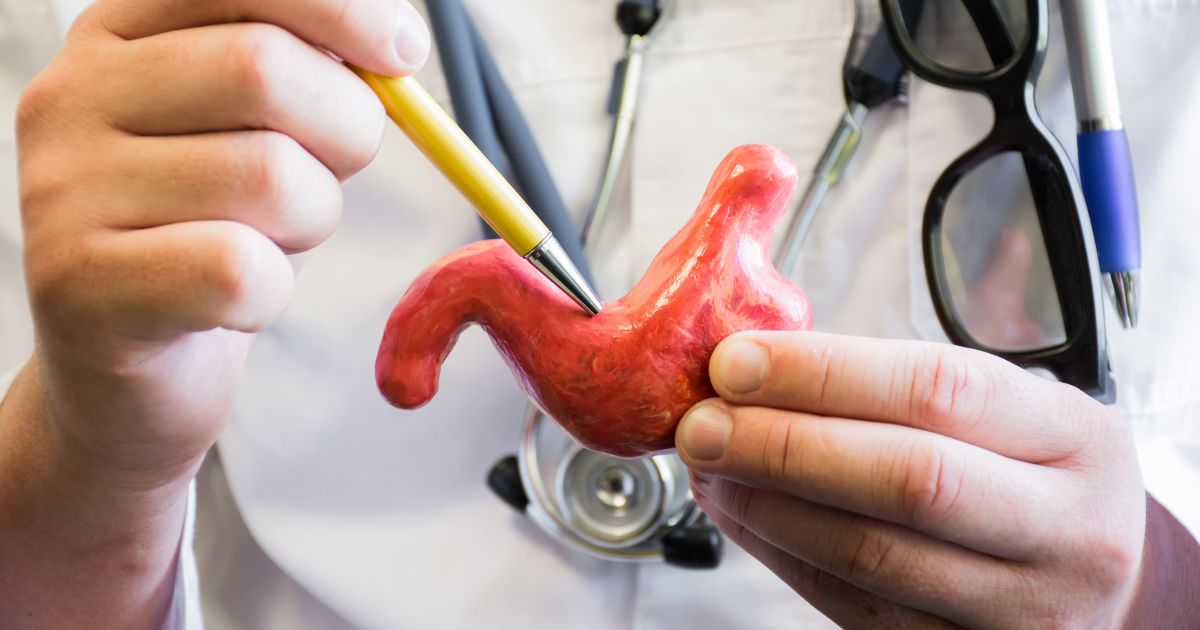 What to know about gastroesophageal junction (GEJ) cancer - Sharecare